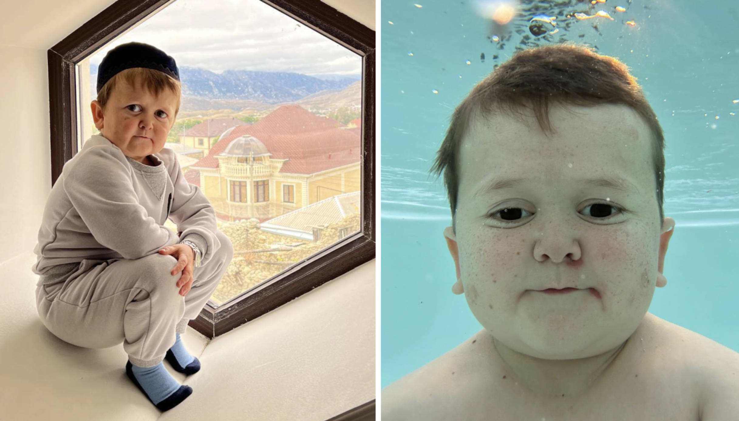 Tiktok-stjärnan Hasbullas, 20, utseende hånas på nya bilden