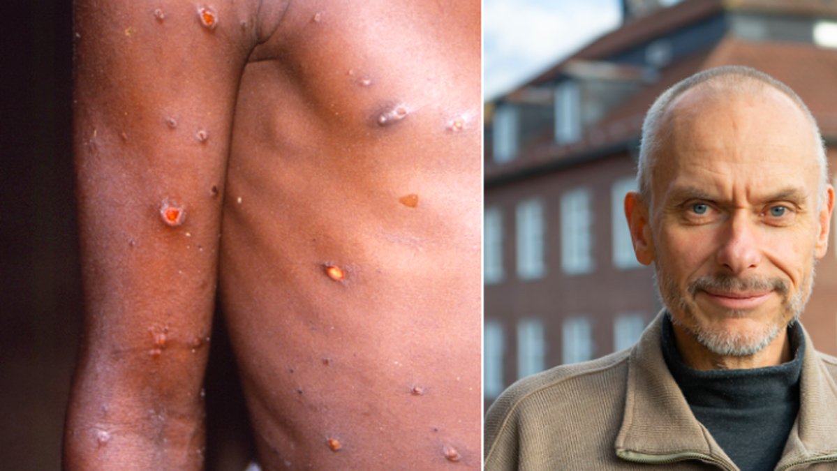 Experten om risken för att apkoppor muterar sig: Ska inte uteslutas