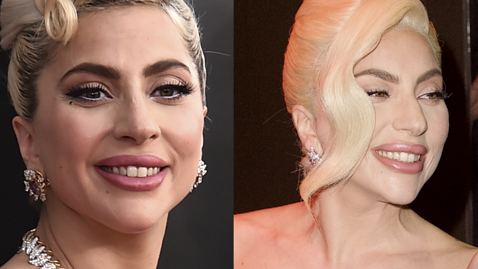 Lady Gagas nya utseende chockar fansen: "Ser ut att explodera"