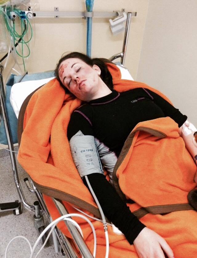 Erica slogs blodig och släpades in i skogen – "Tänkte: 'nu dör jag'"