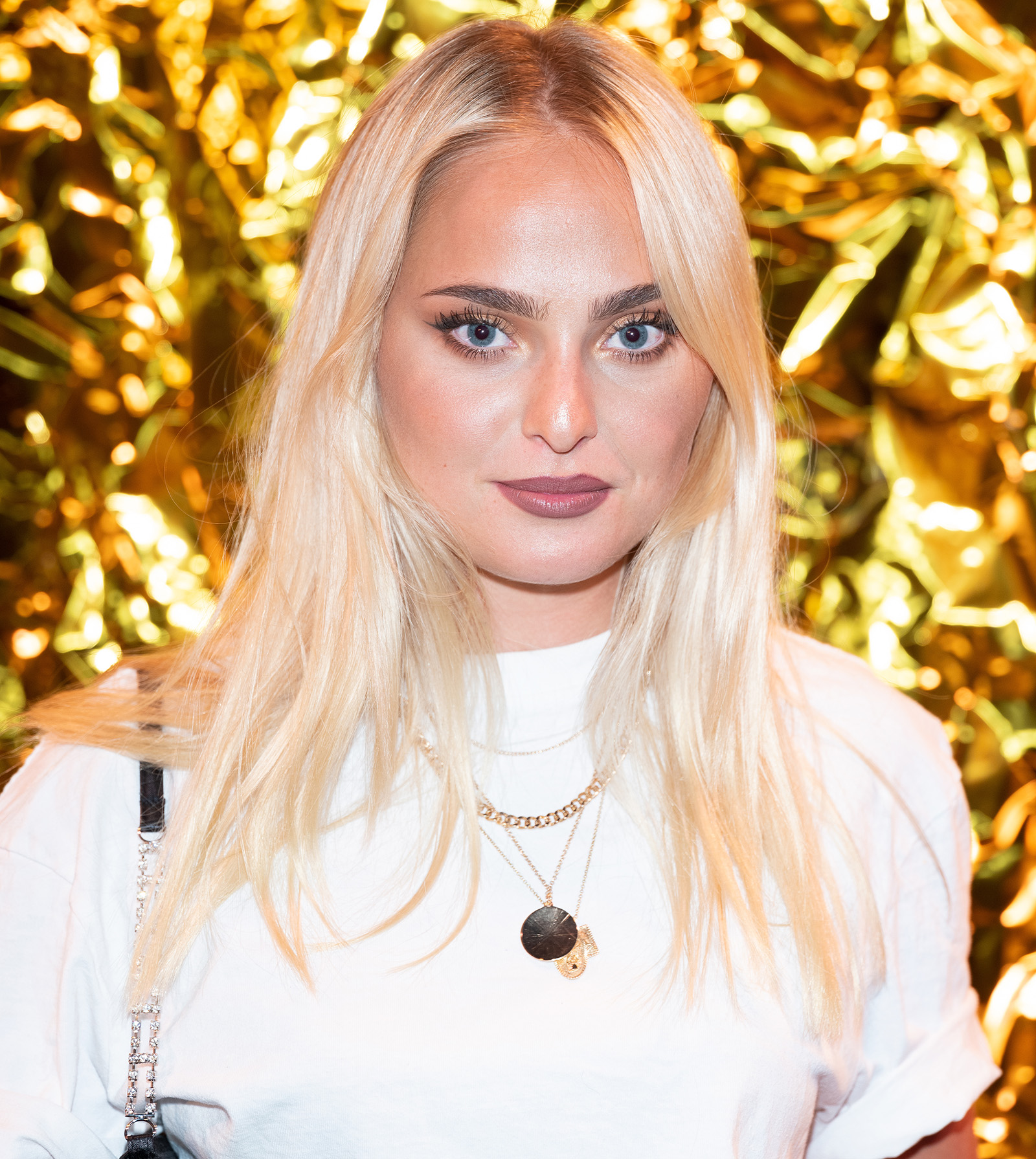 Bilderna visar Alice Stenlöf innan och efter sina skönhetsoperationer